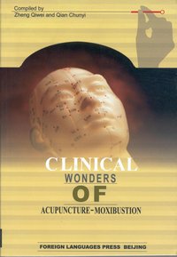 CARBO MEDICAL SUPPLIES - Clinical Wonders of Acupuncture - Moxibustion - Product Details